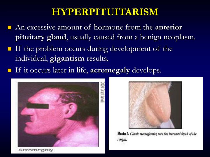 PPT - Oral Manifestations of Systemic Diseases PowerPoint Presentation ...