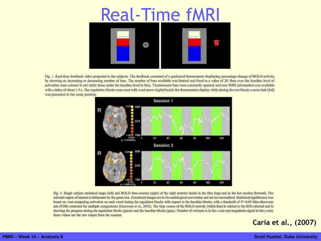 PPT - FMRI Data Analysis: II. Advanced Data Analysis PowerPoint ... PPT - FMRI Data Analysis: II. Advanced Data Analysis PowerPoint ...