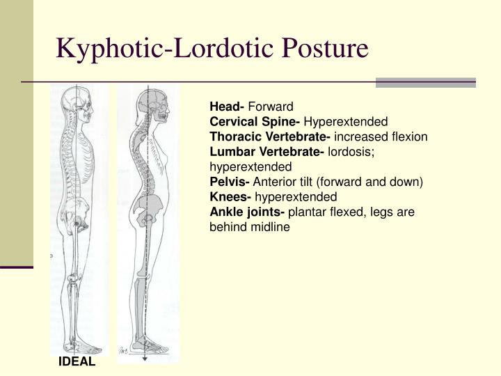Ppt Fundamentals Of Posture Powerpoint Presentation Id 5563850