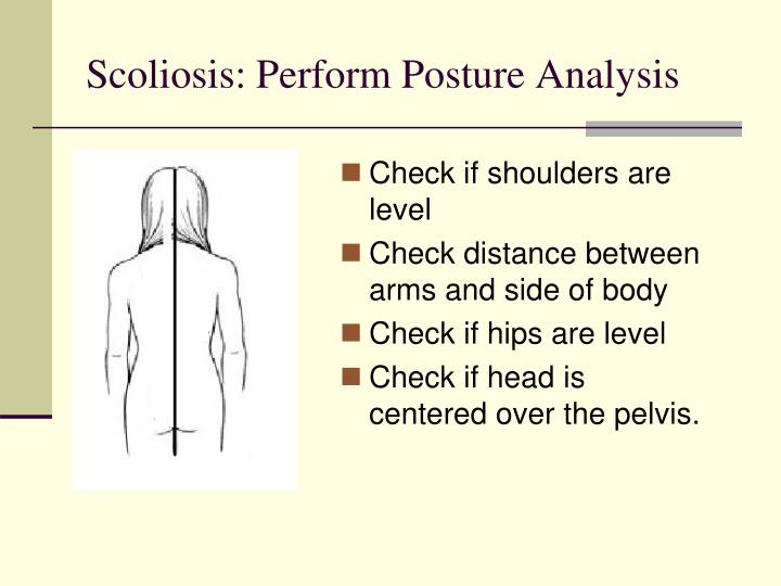 PPT - Fundamentals of Posture PowerPoint Presentation - ID:5563850