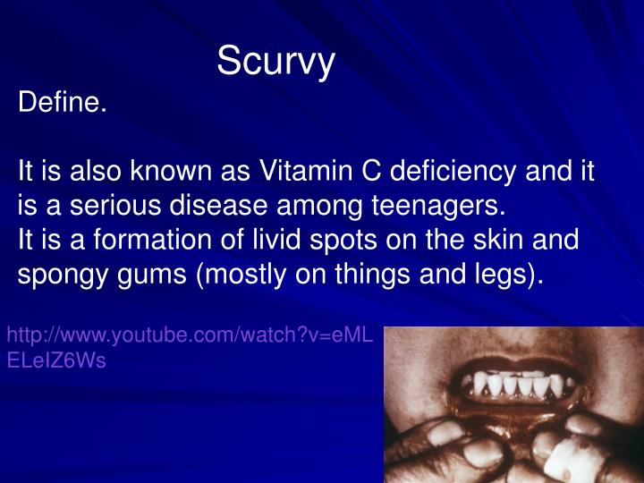 PPT - Spina Bifida . Scurvy. PowerPoint Presentation - ID:5564141
