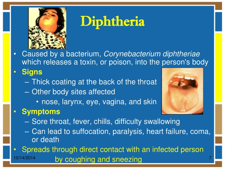 PPT - Vaccine Preventable Diseases PowerPoint Presentation - ID:5564964