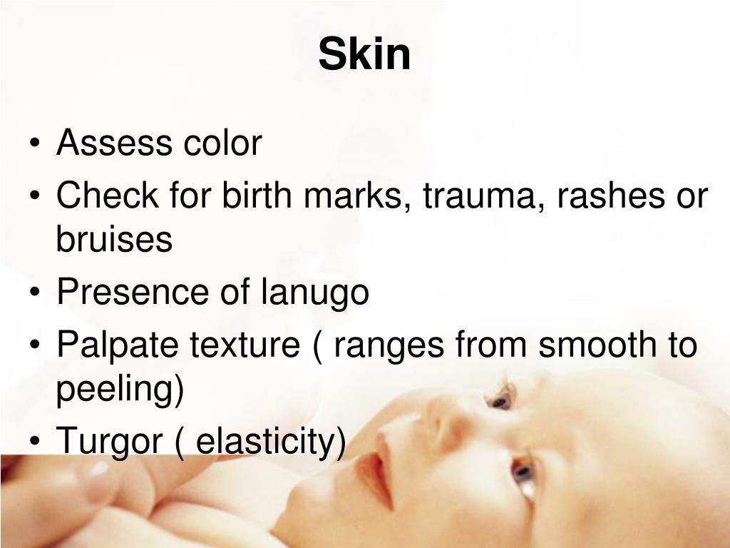 Ppt Newborn Transition Assessment Powerpoint Presentation Free