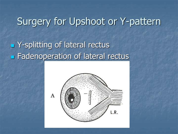 PPT - Duane’s Syndrome PowerPoint Presentation - ID:5571043