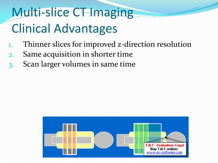 PPT - Multi-Slice CT PowerPoint Presentation - ID:5573730