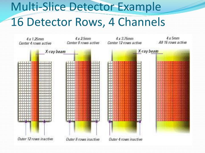 PPT - Multi-Slice CT PowerPoint Presentation - ID:5573730