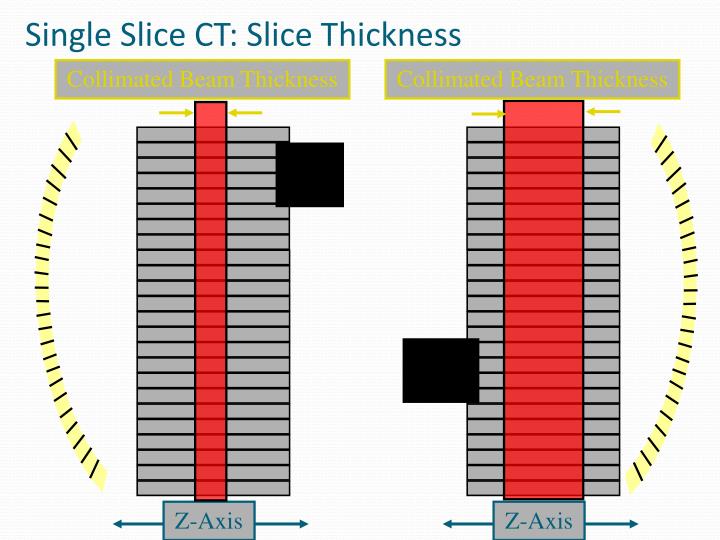 PPT - Multi-Slice CT PowerPoint Presentation - ID:5573730