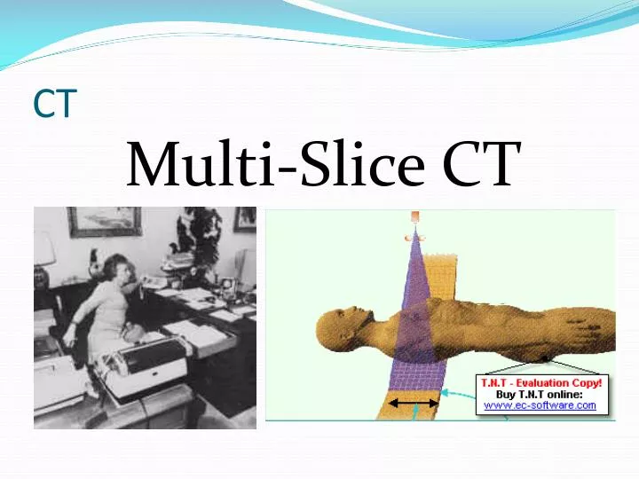 PPT - Multi-Slice CT PowerPoint Presentation, free download - ID:5573730