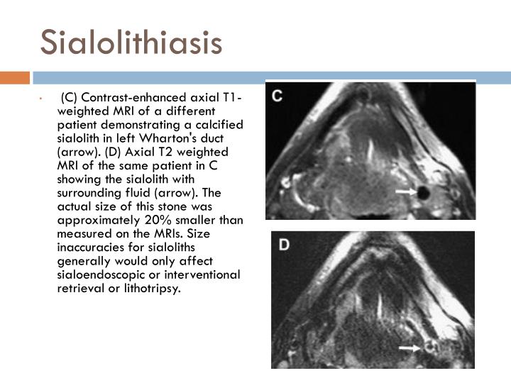 PPT - RADIOGRAPHIC INTERPRETATION OF INFECTION & TRAUMA PowerPoint ...