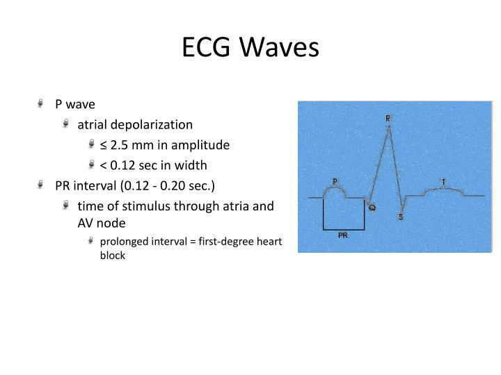 PPT - ECG Interpretation PowerPoint Presentation - ID:5576062
