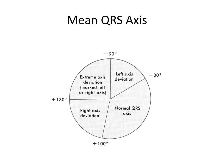 PPT - ECG Interpretation PowerPoint Presentation - ID:5576062