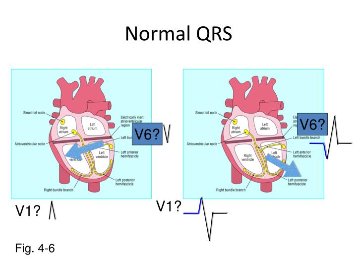 PPT - ECG Interpretation PowerPoint Presentation - ID:5576062