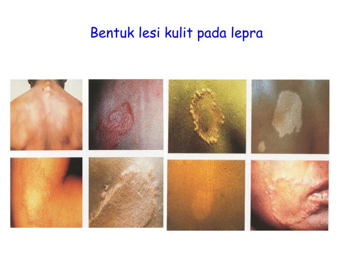 PPT - KUSTA PowerPoint Presentation - ID:5576201