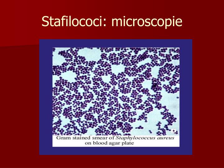 PPT - Microbiologie Master: Biotehnologii avansate PowerPoint ...