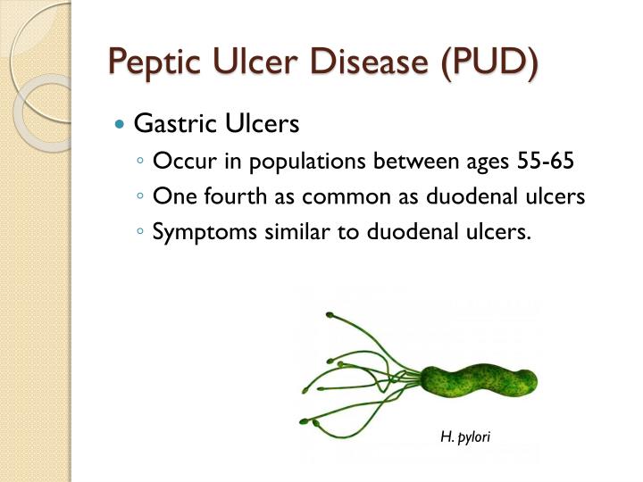 PPT - Alterations of the GI Tract PowerPoint Presentation - ID:5576803