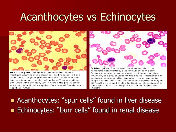 PPT - Anemia PowerPoint Presentation - ID:5577268