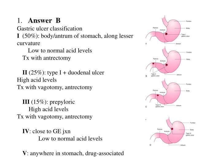PPT - 1. Answer B Gastric ulcer classification I (50%): body/antrum of ...