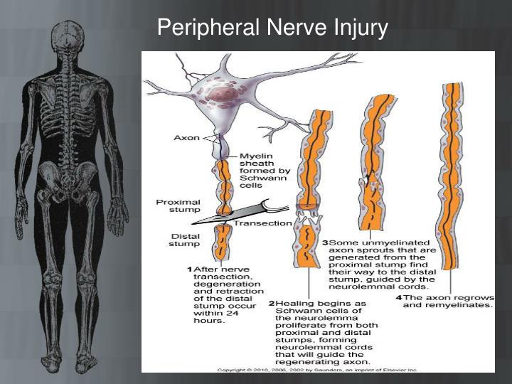 PPT - Chapter 46 PowerPoint Presentation - ID:5581320