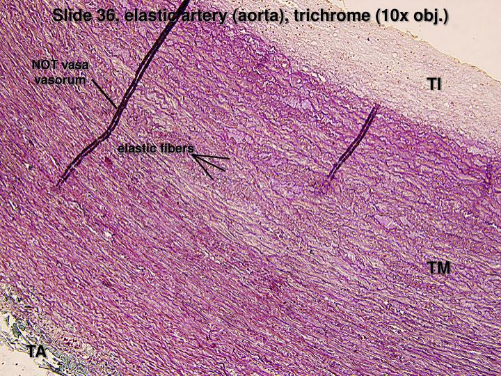 PPT - Slide 88, elastic artery (aorta), (10x obj.) PowerPoint ...