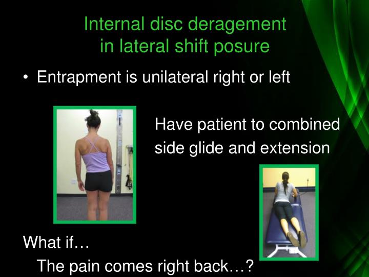 PPT - The Internal Disc Derangement Syndrome PowerPoint Presentation ...
