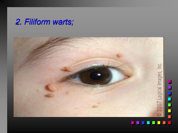 PPT - Viral Skin Diseases PowerPoint Presentation - ID:5588920