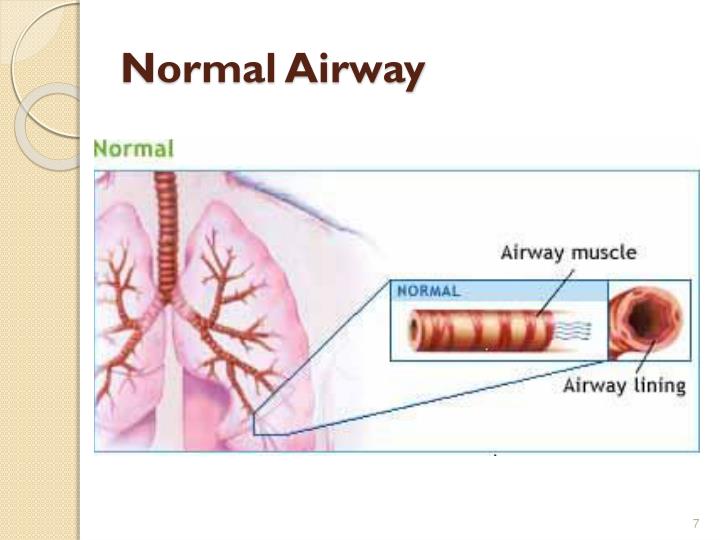 PPT - ASTHMA and ALLERGIES PowerPoint Presentation - ID:5590843