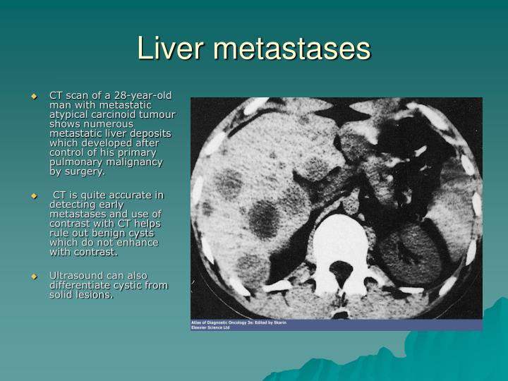 PPT - NSCLCa – a pictorial lesson PowerPoint Presentation - ID:5593120