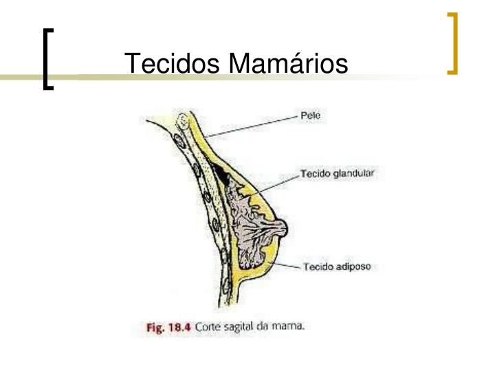 PPT - Mamografia PowerPoint Presentation - ID:5594957