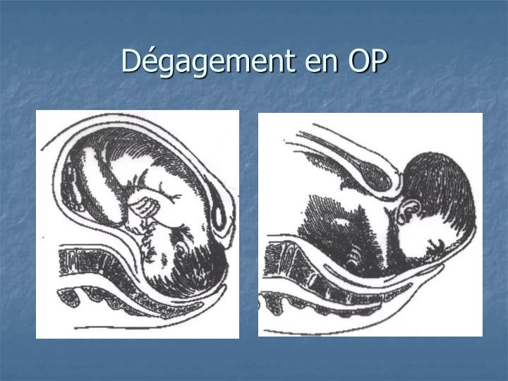 PPT - Accouchement normal PowerPoint Presentation - ID:5595144