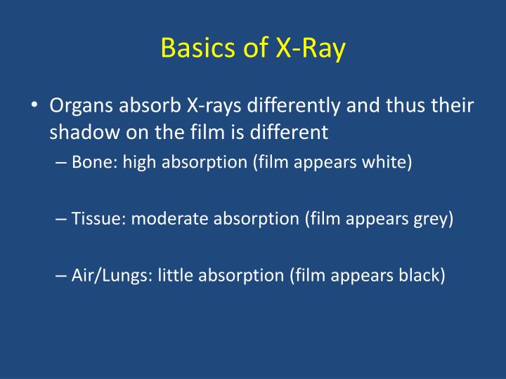 PPT - Basics of Chest X-Ray PowerPoint Presentation - ID:5595574