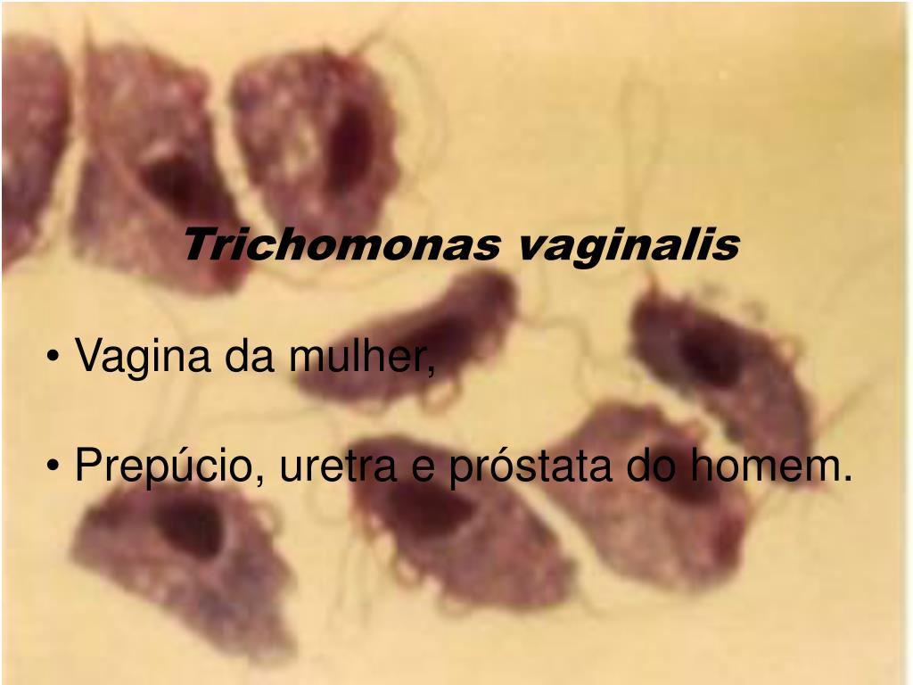 PPT - Trichomonas vaginalis Vagina da mulher, Prepúcio, uretra e ...