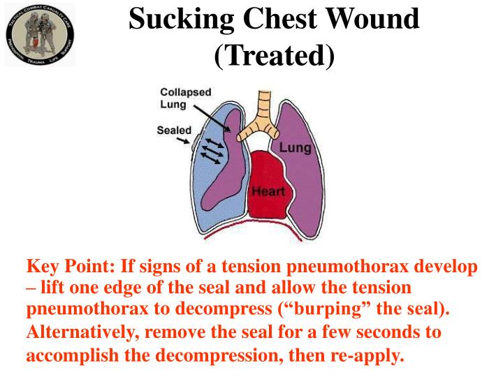 PPT - Tactical Combat Casualty Care 02 June 2014 PowerPoint ...
