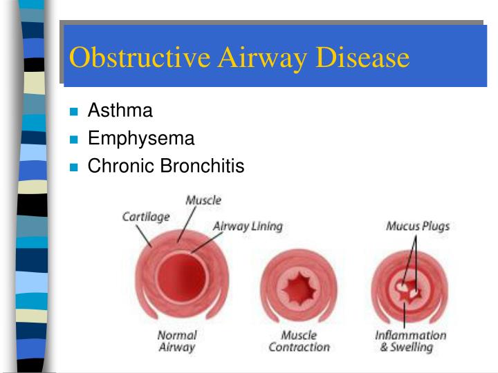 PPT - Pulmonary Diseases PowerPoint Presentation - ID:5601831