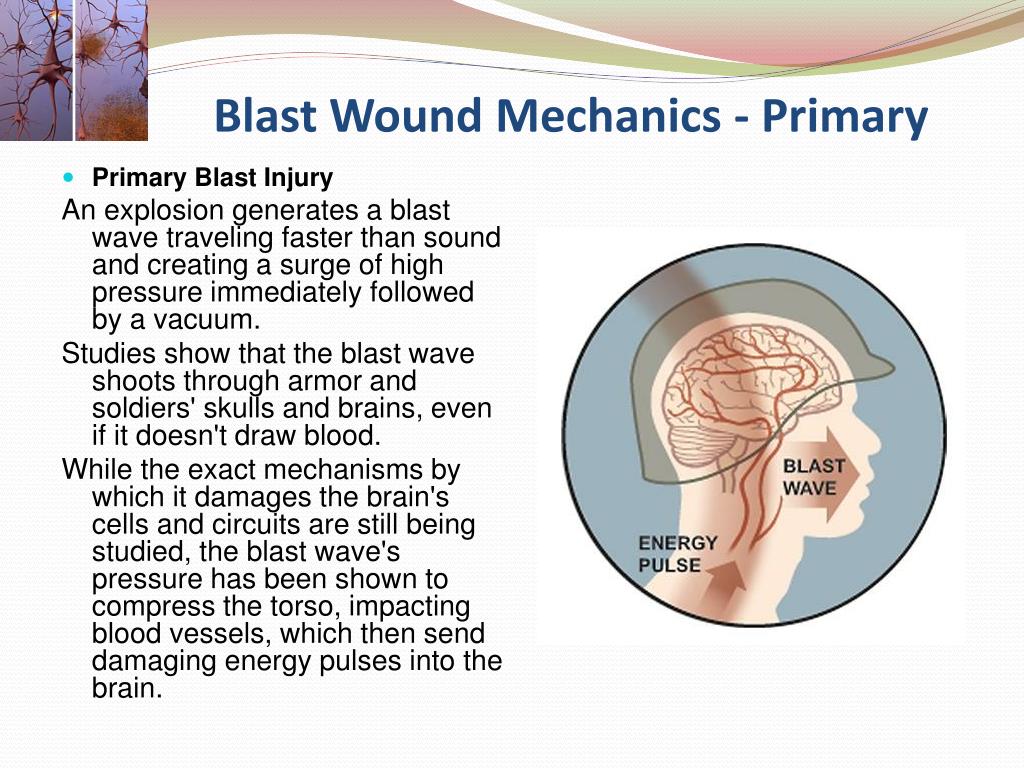 PPT - Patricia S. Benfield , MHDL, CRT, CBIS-CI, CCAA North Carolina ...