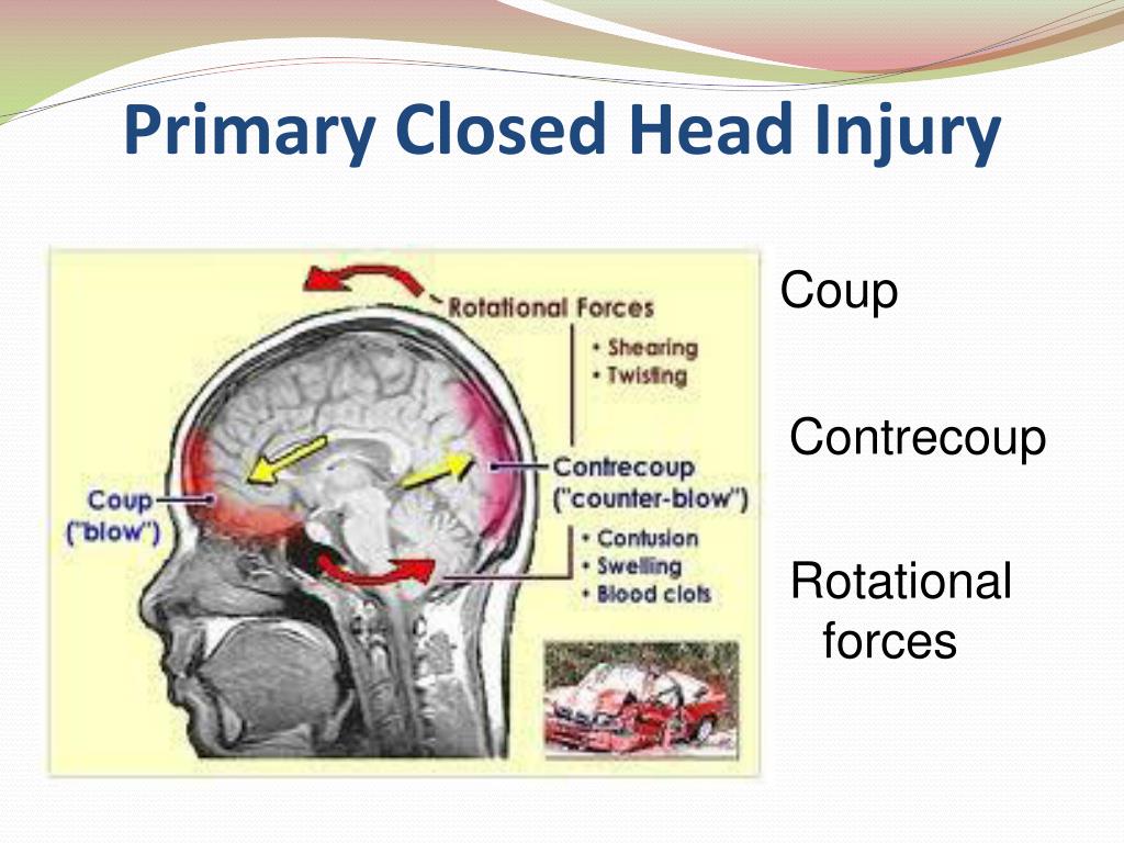 PPT - Patricia S. Benfield , MHDL, CRT, CBIS-CI, CCAA North Carolina ...