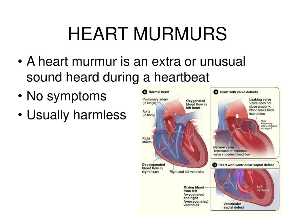 Ppt Circulatory Disorders Powerpoint Presentation Free Download Id