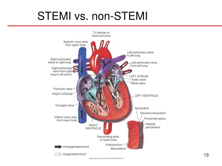 PPT - Nursing Priorities in Acute Coronary Syndromes PowerPoint ...