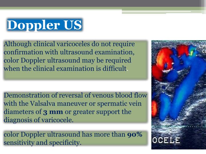 PPT - Varicocele PowerPoint Presentation - ID:5611226