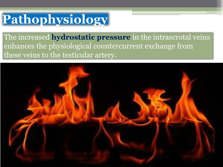 PPT - Varicocele PowerPoint Presentation - ID:5611226