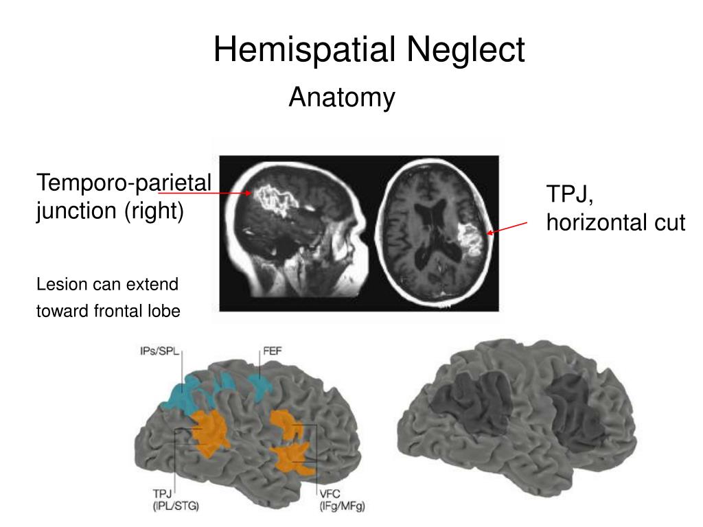 PPT - “Everyone knows what attention is… William James, 1890 PowerPoint ...