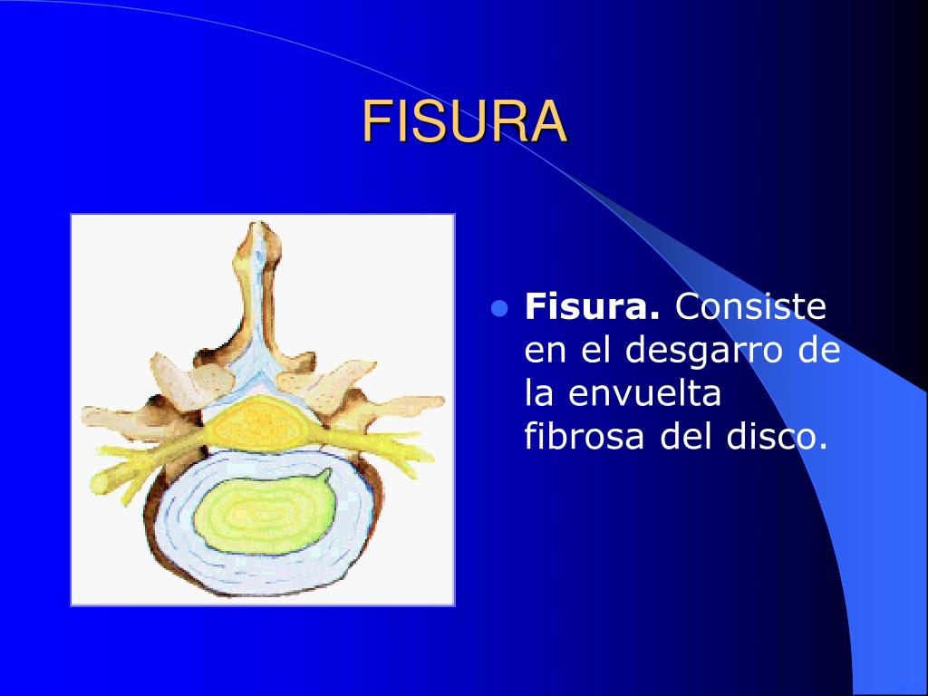 PPT - GUIA DE ATENCION DE ENFERMERIA EN PACIENTES SOMETIDOS A CIRUGIA ...