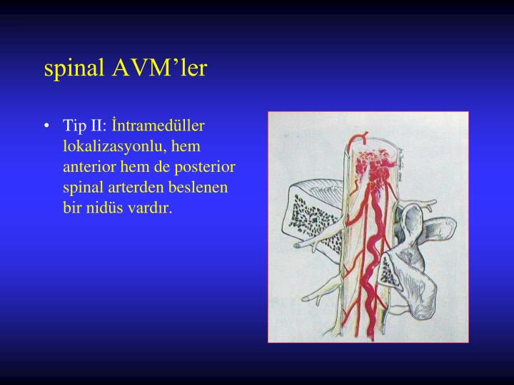 PPT - merkezi sinir sisteminin vasküler malformasyonları PowerPoint ...