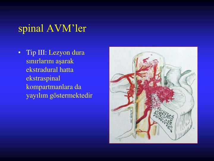 PPT - merkezi sinir sisteminin vasküler malformasyonları PowerPoint ...