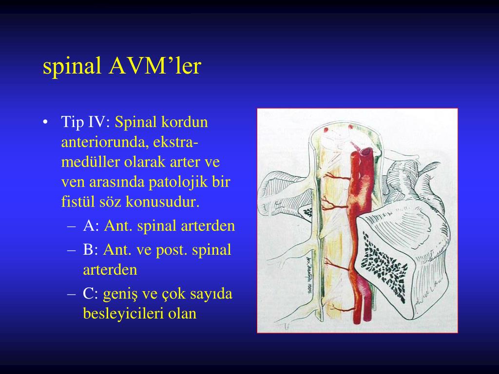 PPT - merkezi sinir sisteminin vasküler malformasyonları PowerPoint ...