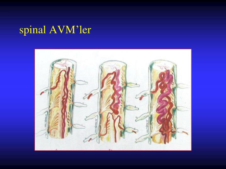 PPT - merkezi sinir sisteminin vasküler malformasyonları PowerPoint ...