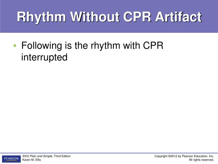 PPT - Figure 4-11 CPR Artifact PowerPoint Presentation - ID:5620621