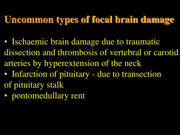 PPT - Head injury PowerPoint Presentation - ID:5622026