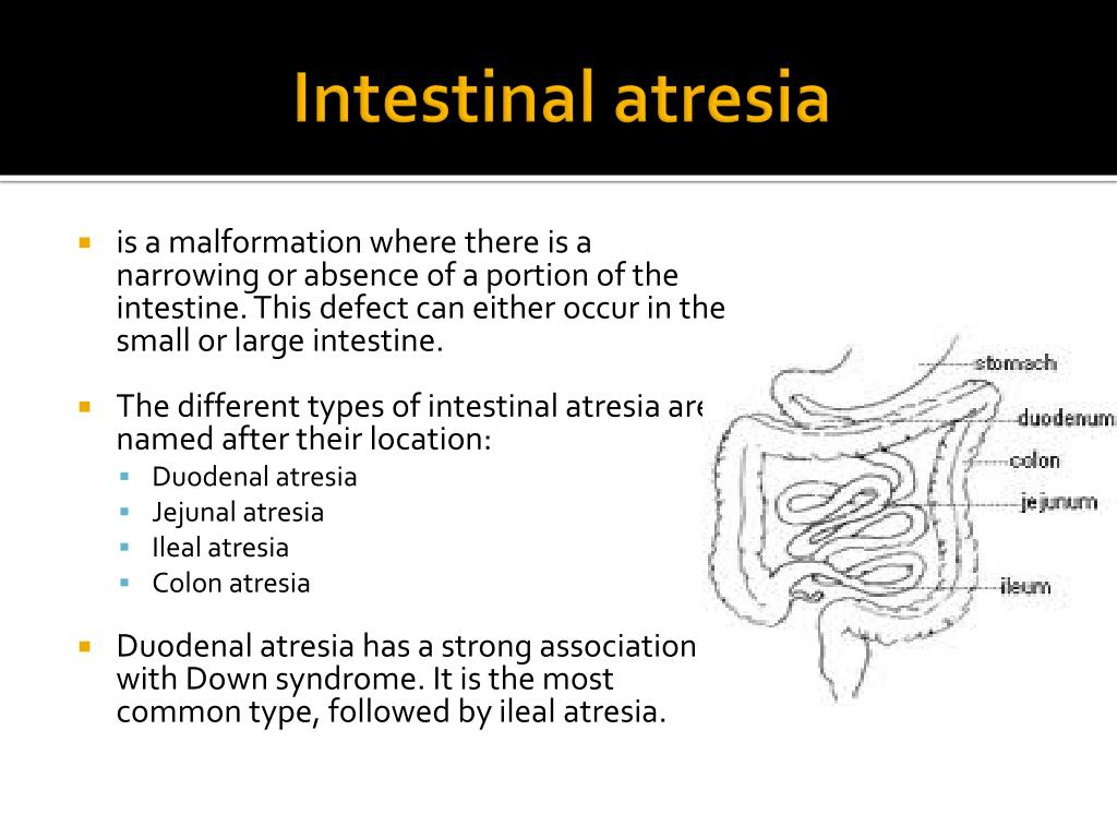 Ppt Approach To Common Pediatric Surgical Problems Powerpoint