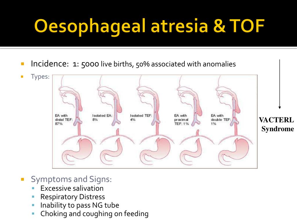 Ppt Approach To Common Pediatric Surgical Problems Powerpoint