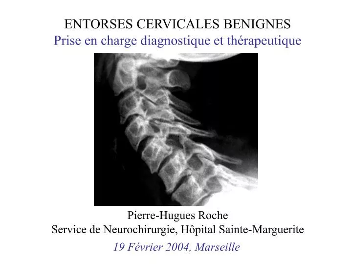 PPT - ENTORSES CERVICALES BENIGNES Prise en charge diagnostique et ...